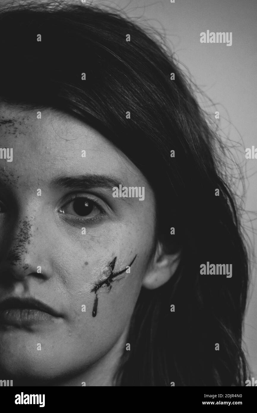 Face injury blood Black and White Stock Photos & Images - Alamy