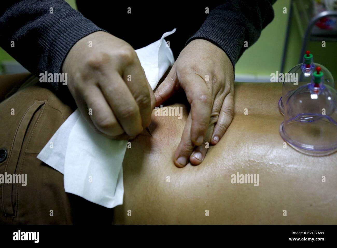 Tighter skin hi-res stock photography and images - Alamy