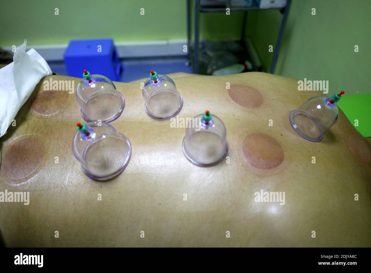 Tighter skin hi-res stock photography and images - Alamy