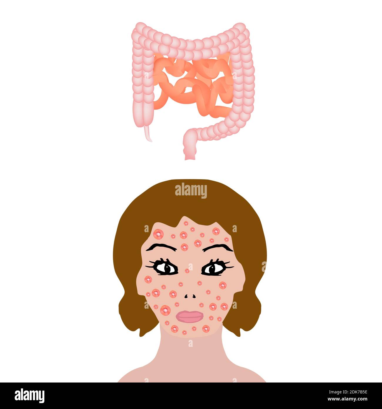 The anatomical structure of the intestine. Bowel diseases affect the ...
