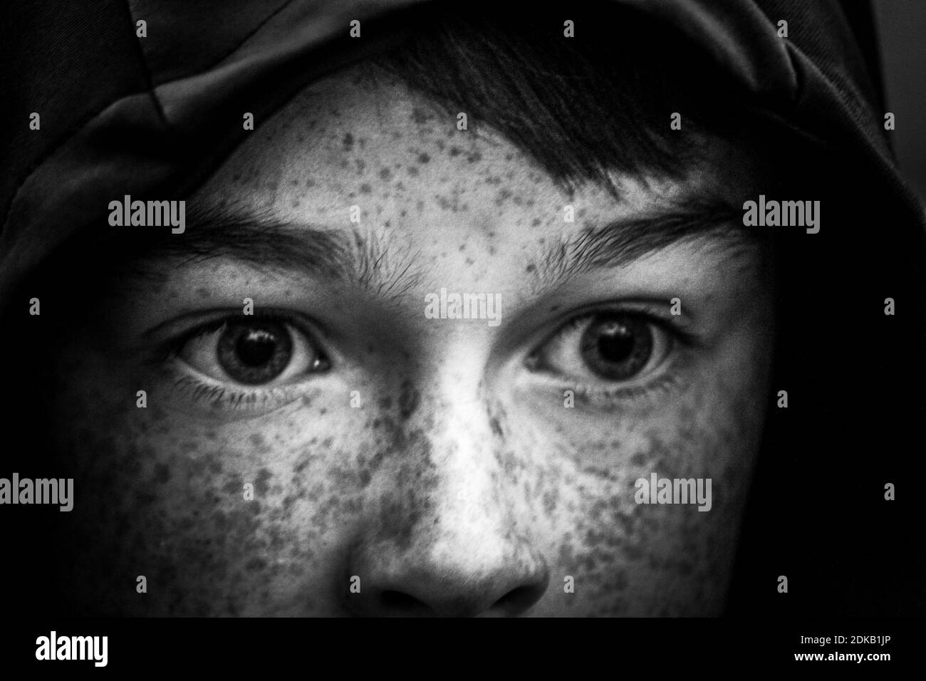 Boy face freckles Black and White Stock Photos & Images - Alamy