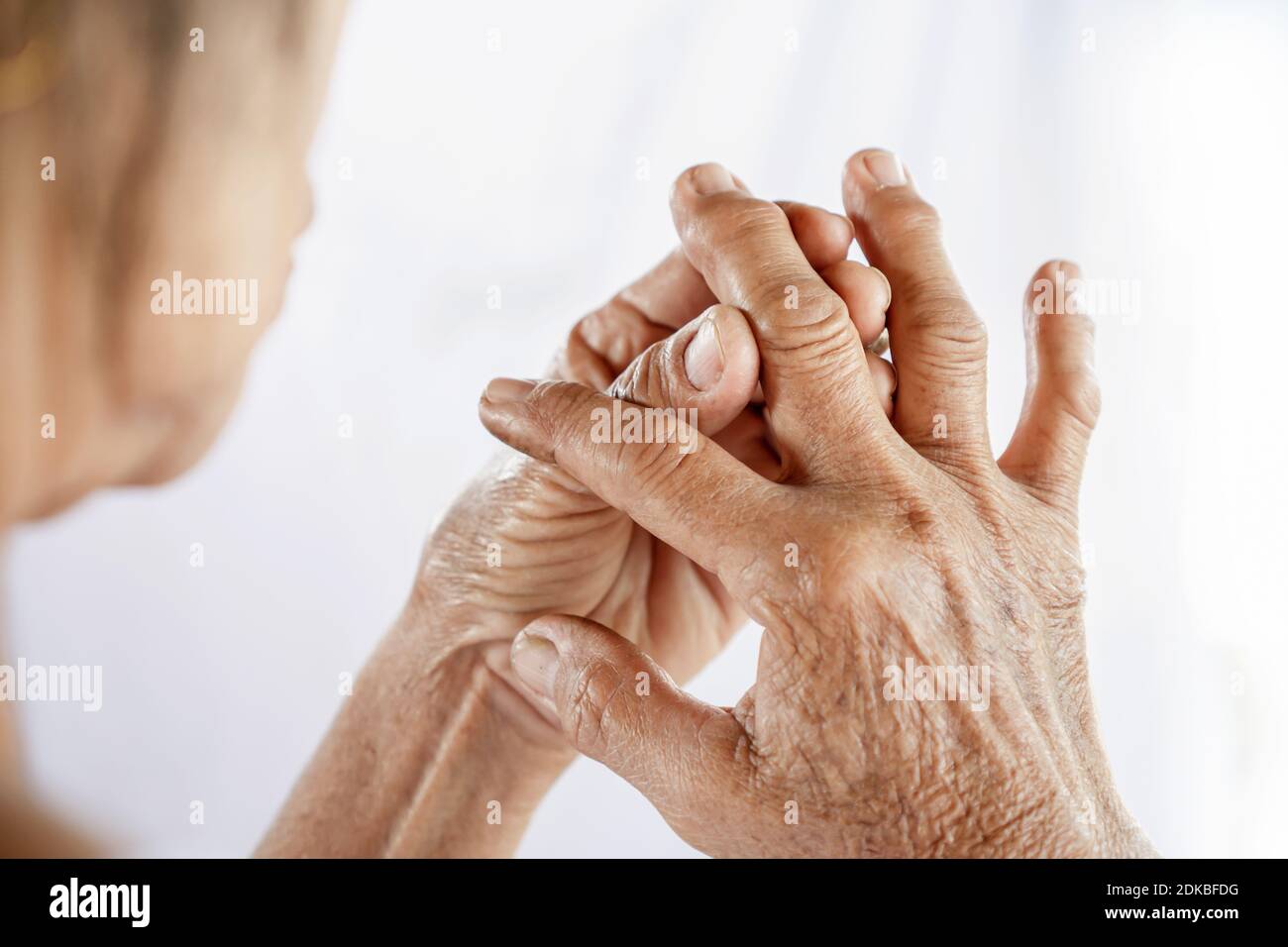 Fractured Finger Hand High Resolution Stock Photography and Images - Alamy