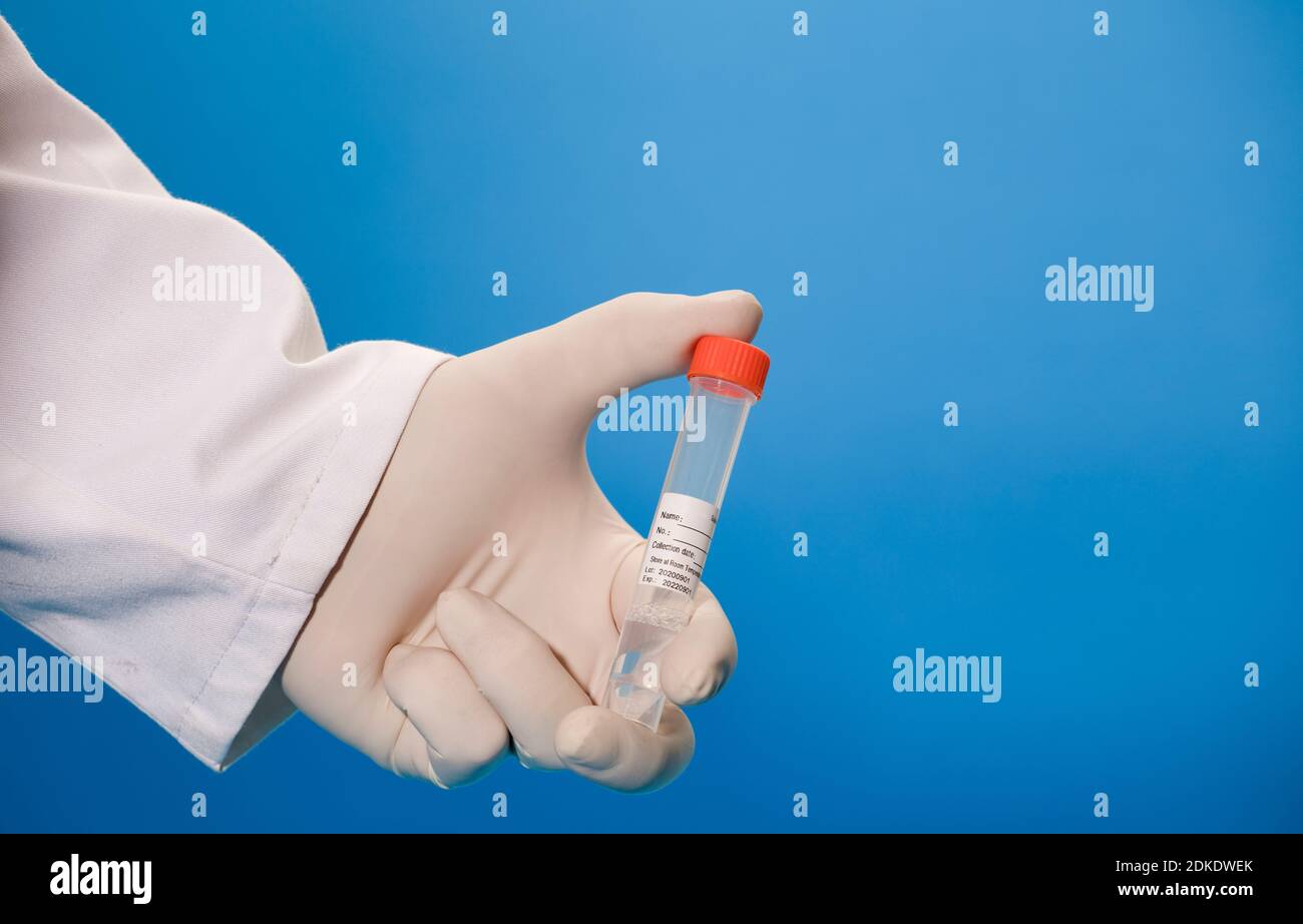 serological test in the hands of a doctor with white surgical gloves ...