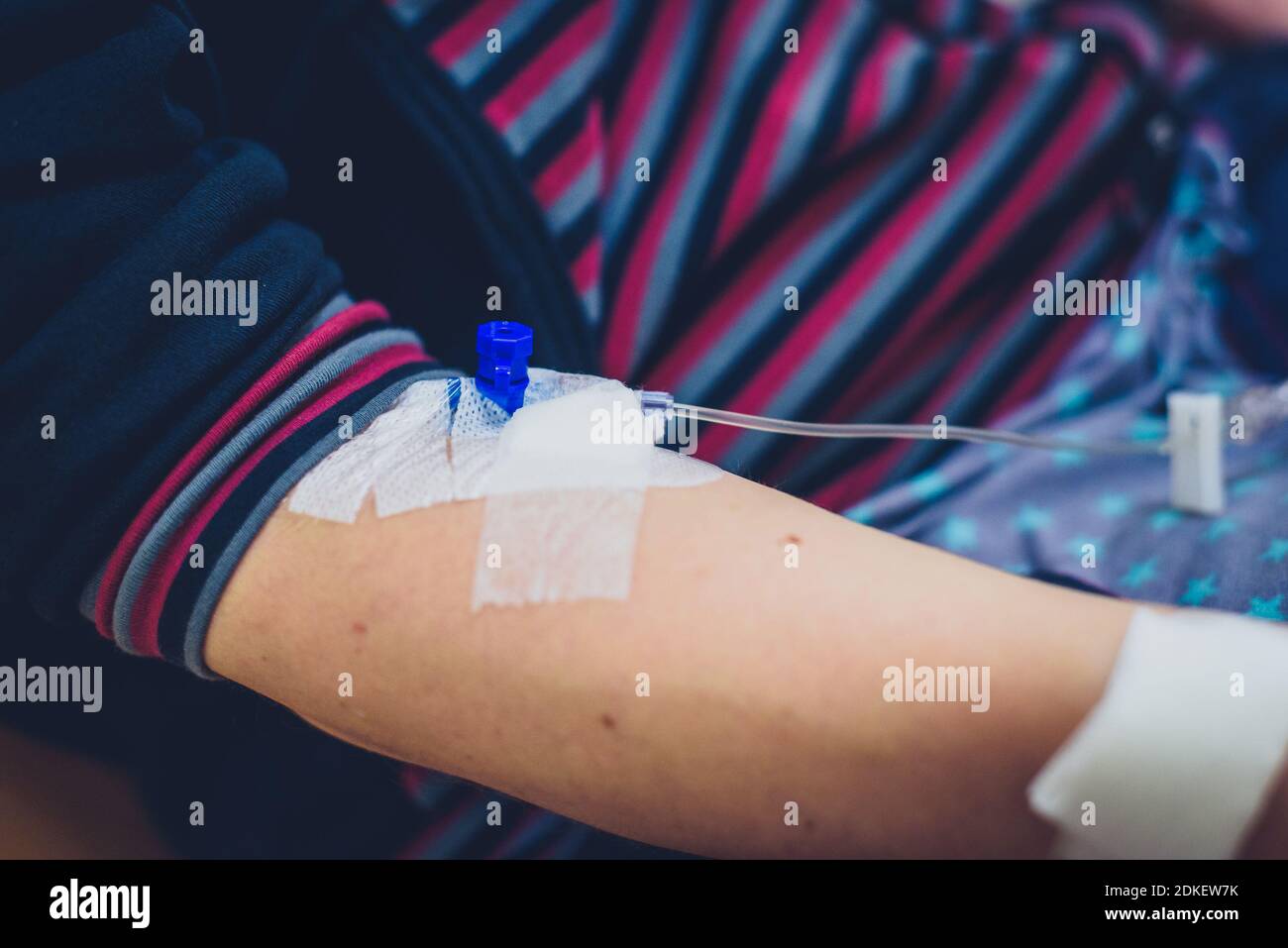 Iv catheter in an arm hi-res stock photography and images - Alamy