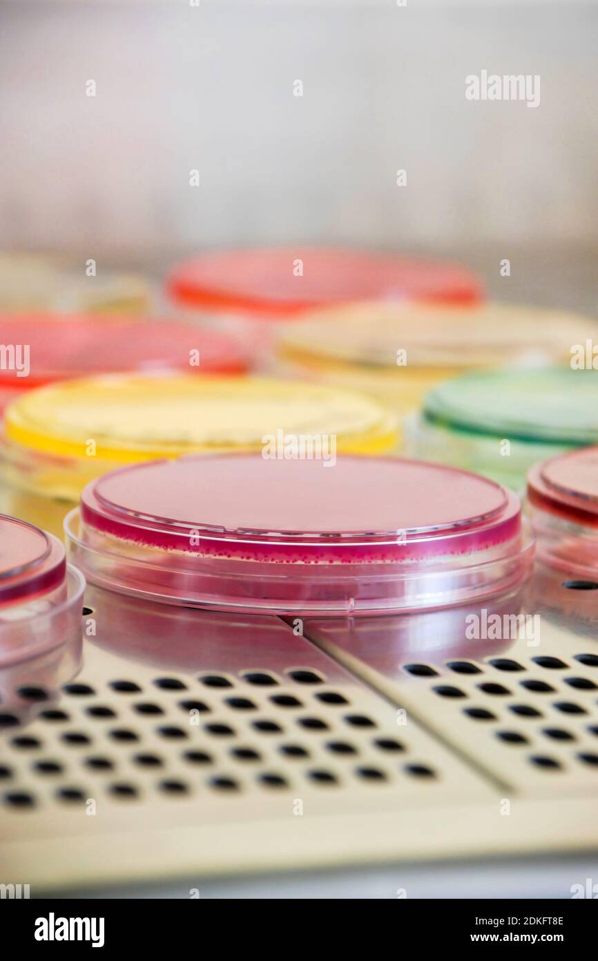 Streptococcus pneumoniae colonies hi-res stock photography and images ...