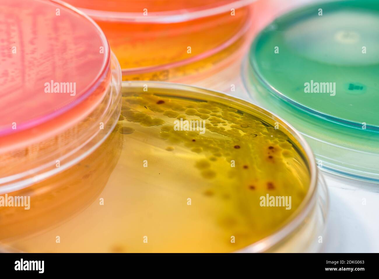 Streak plate agar hi-res stock photography and images - Alamy