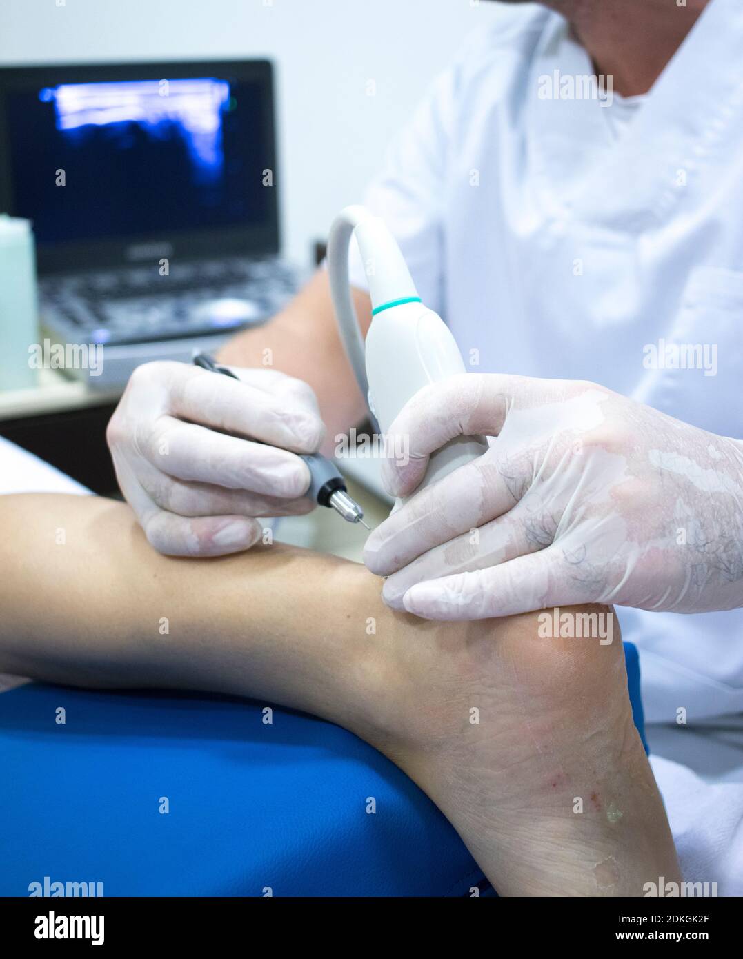 Percutaneous electrolysis hi-res stock photography and images - Alamy