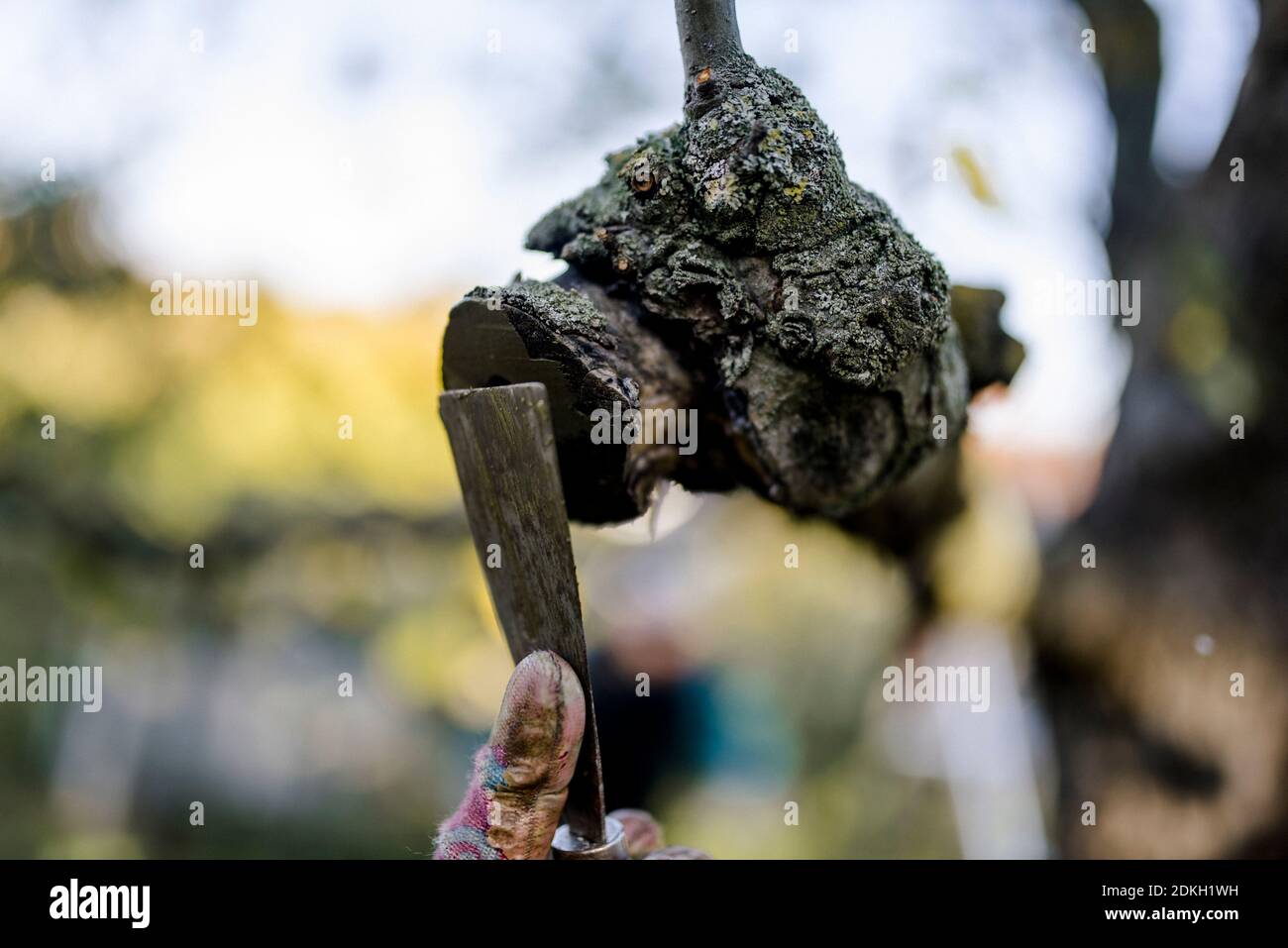 Wound closure hi-res stock photography and images - Alamy