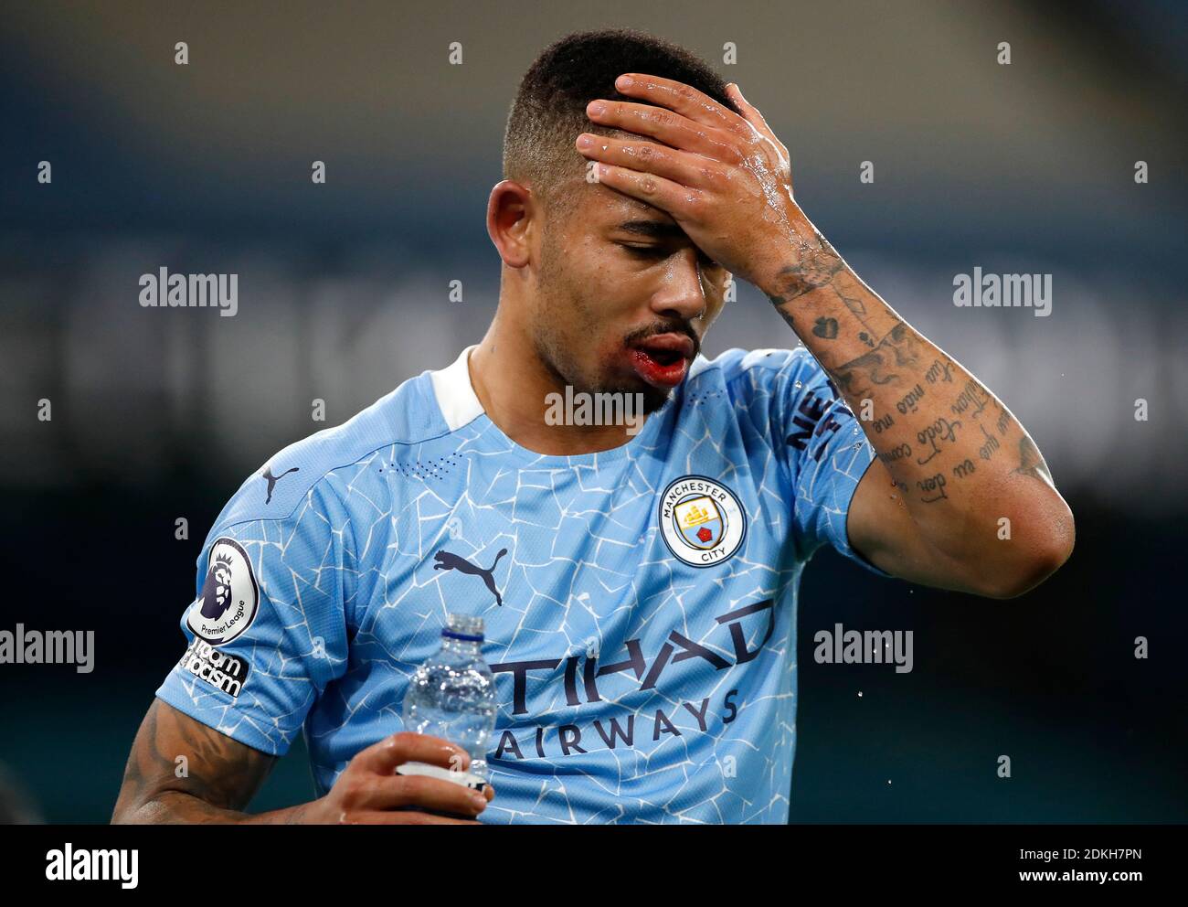 Manchester City's Gabriel Jesus after being hit in the face during the ...