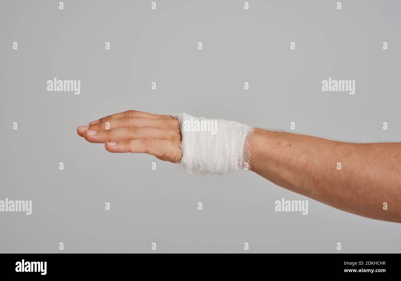 bandaged arm health problem patient injury Studio Stock Photo - Alamy