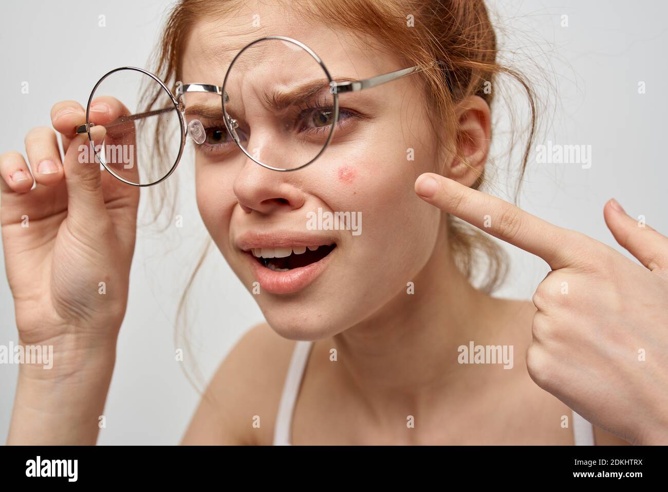 woman in glasses shows a finger to a red pimple on her face Stock Photo ...