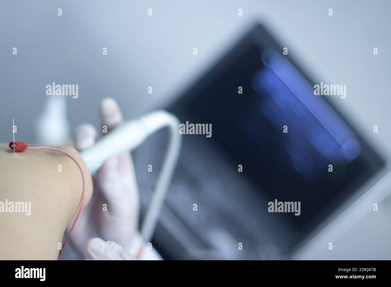 Intratissue hi-res stock photography and images - Alamy