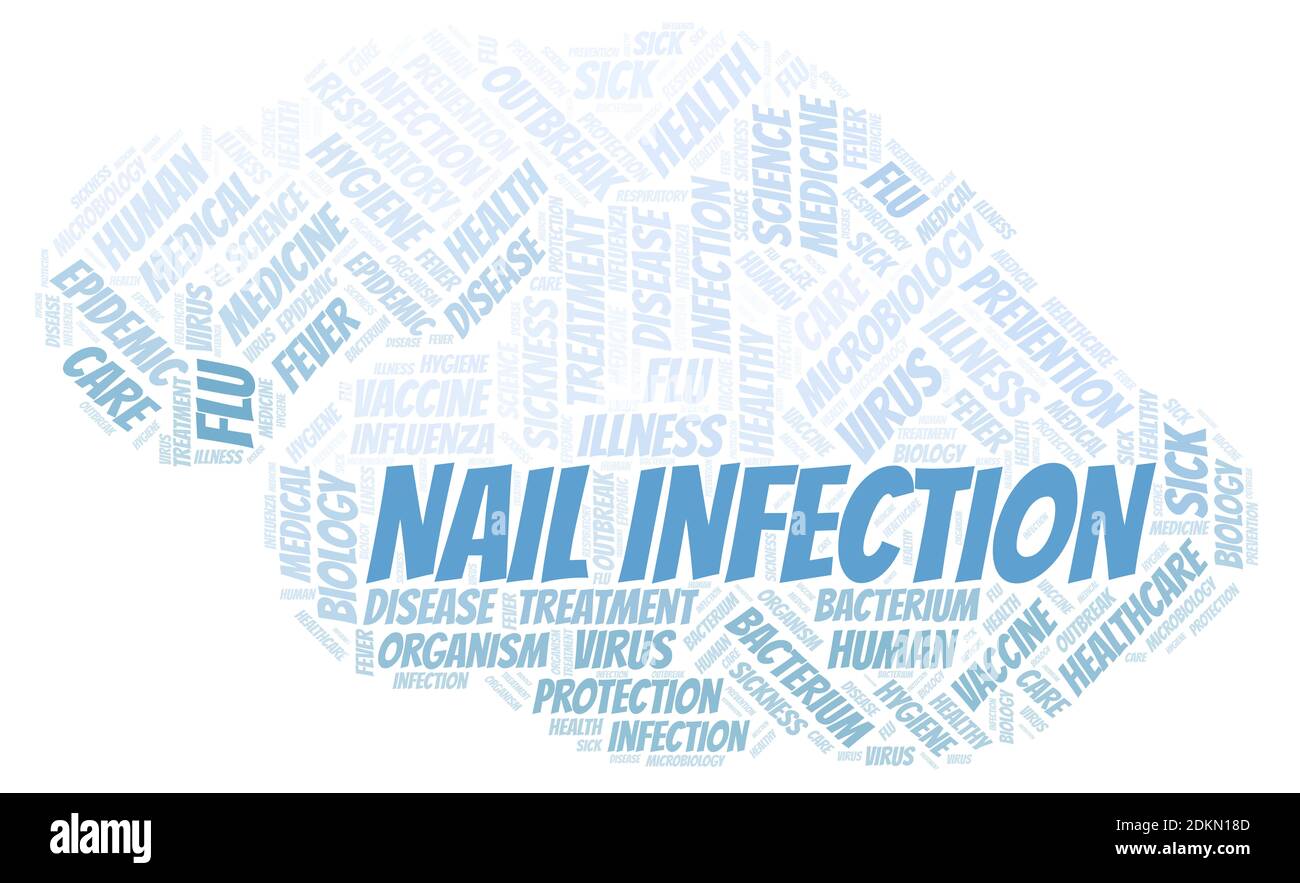 Nail Infection typography word cloud create with text only Stock Photo ...