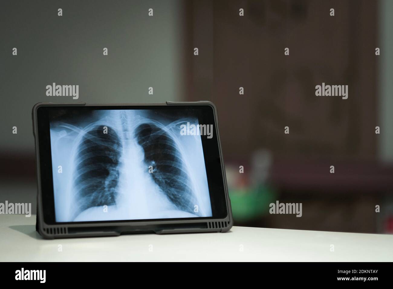 X-ray On Digital Tablet Screen At Hospital Stock Photo - Alamy