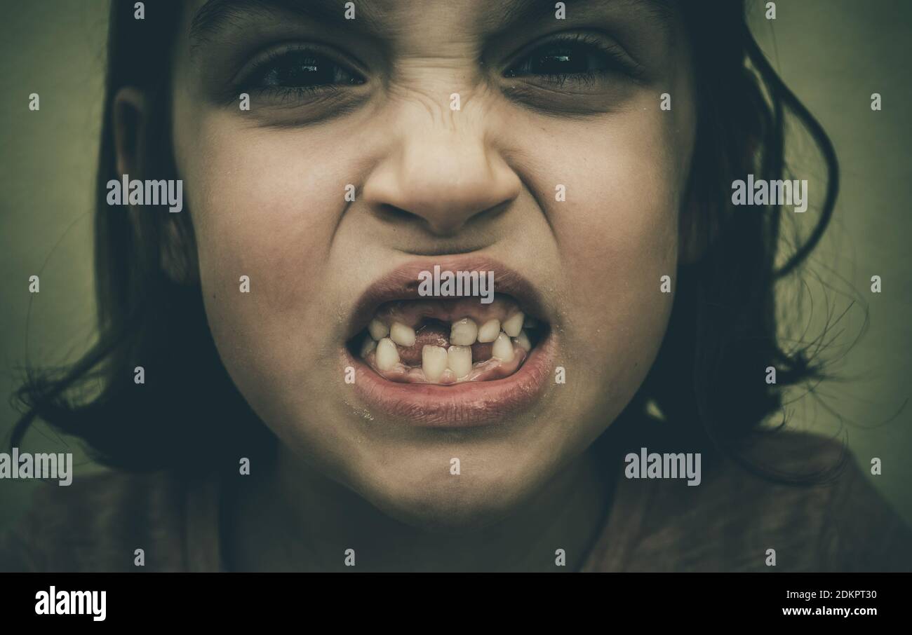 Toothless Child High Resolution Stock Photography and Images - Alamy