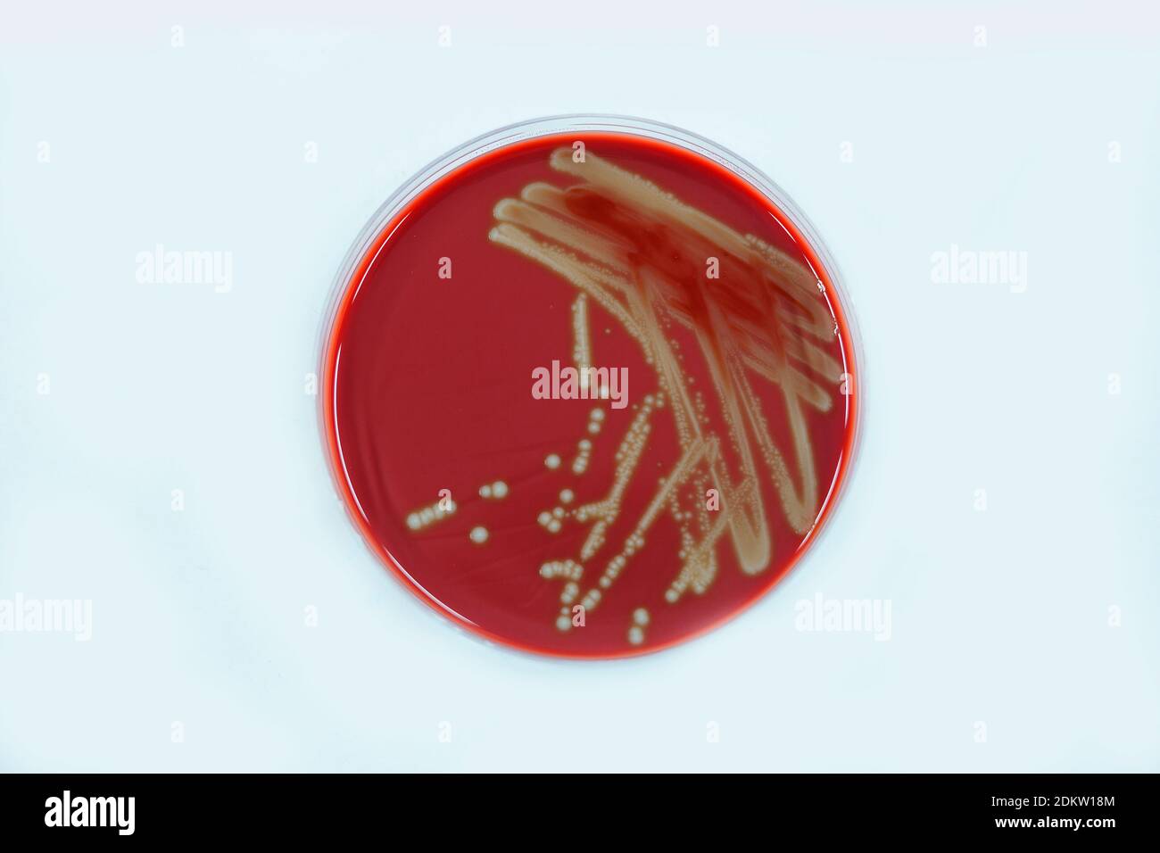 E coli on blood agar hi-res stock photography and images - Alamy