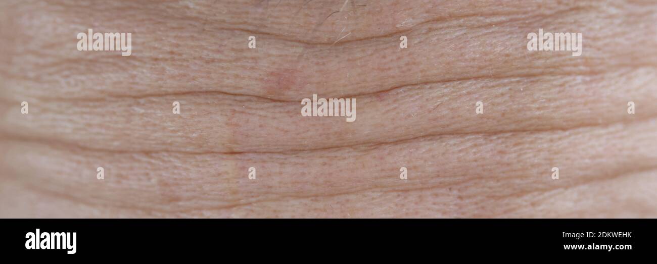 Facial wrinkles on forehead of adult woman closeup Stock Photo - Alamy