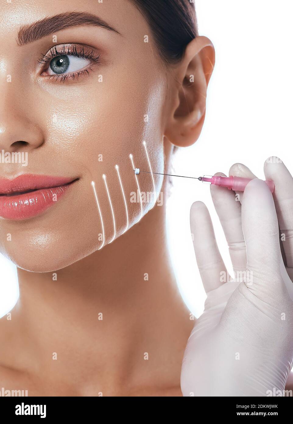 Thread facelift with arrows, concept of lifting skin, close up ...