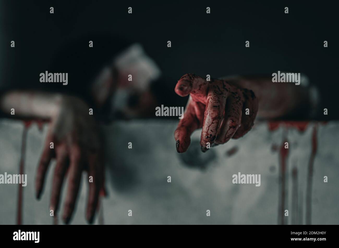 Finger Accidents High Resolution Stock Photography and Images - Alamy