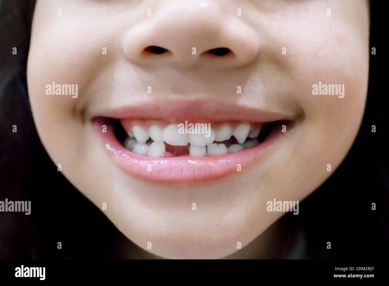 First Tooth High Resolution Stock Photography and Images - Alamy