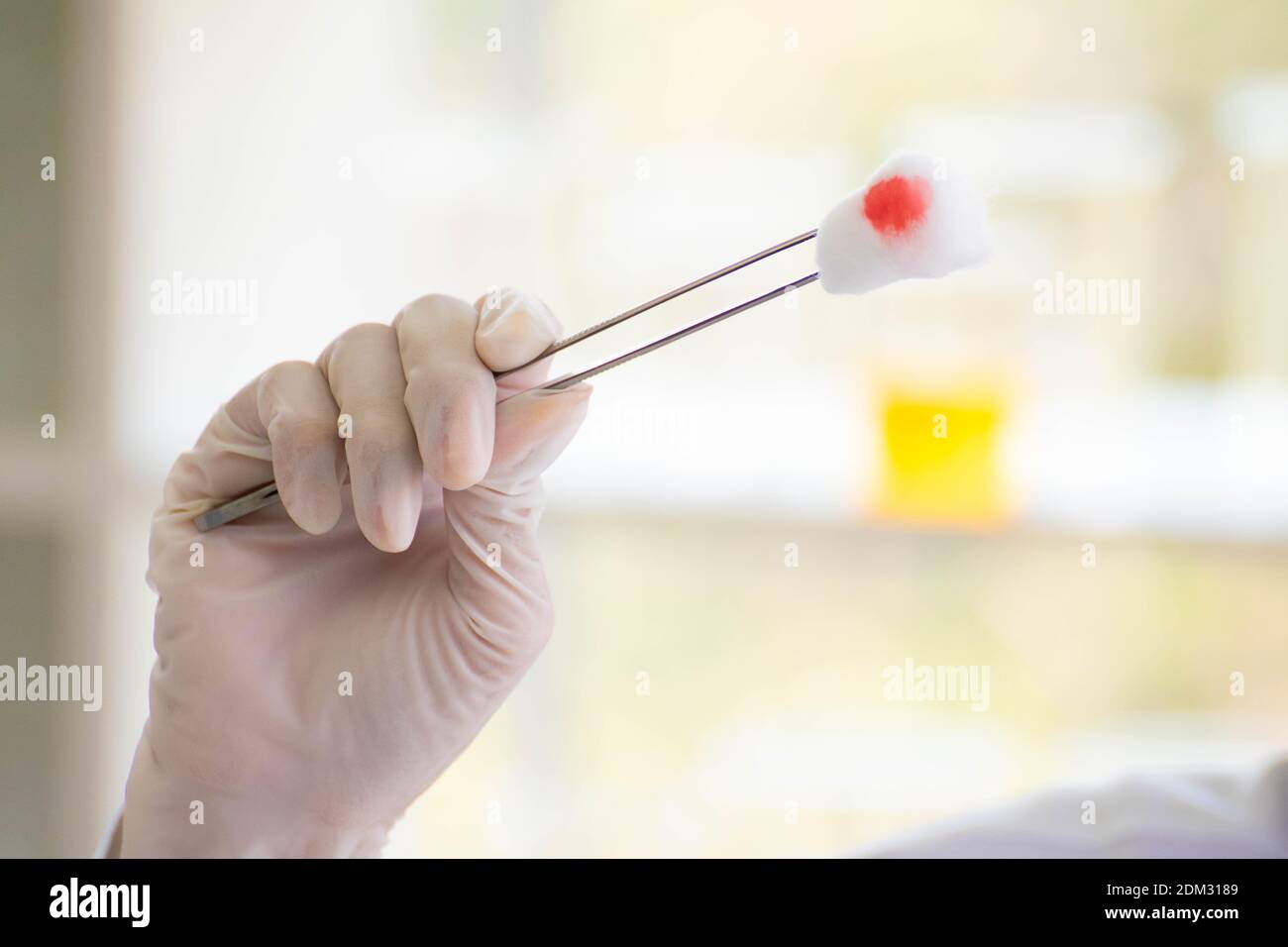 Cotton swab surgical glove hi-res stock photography and images - Alamy