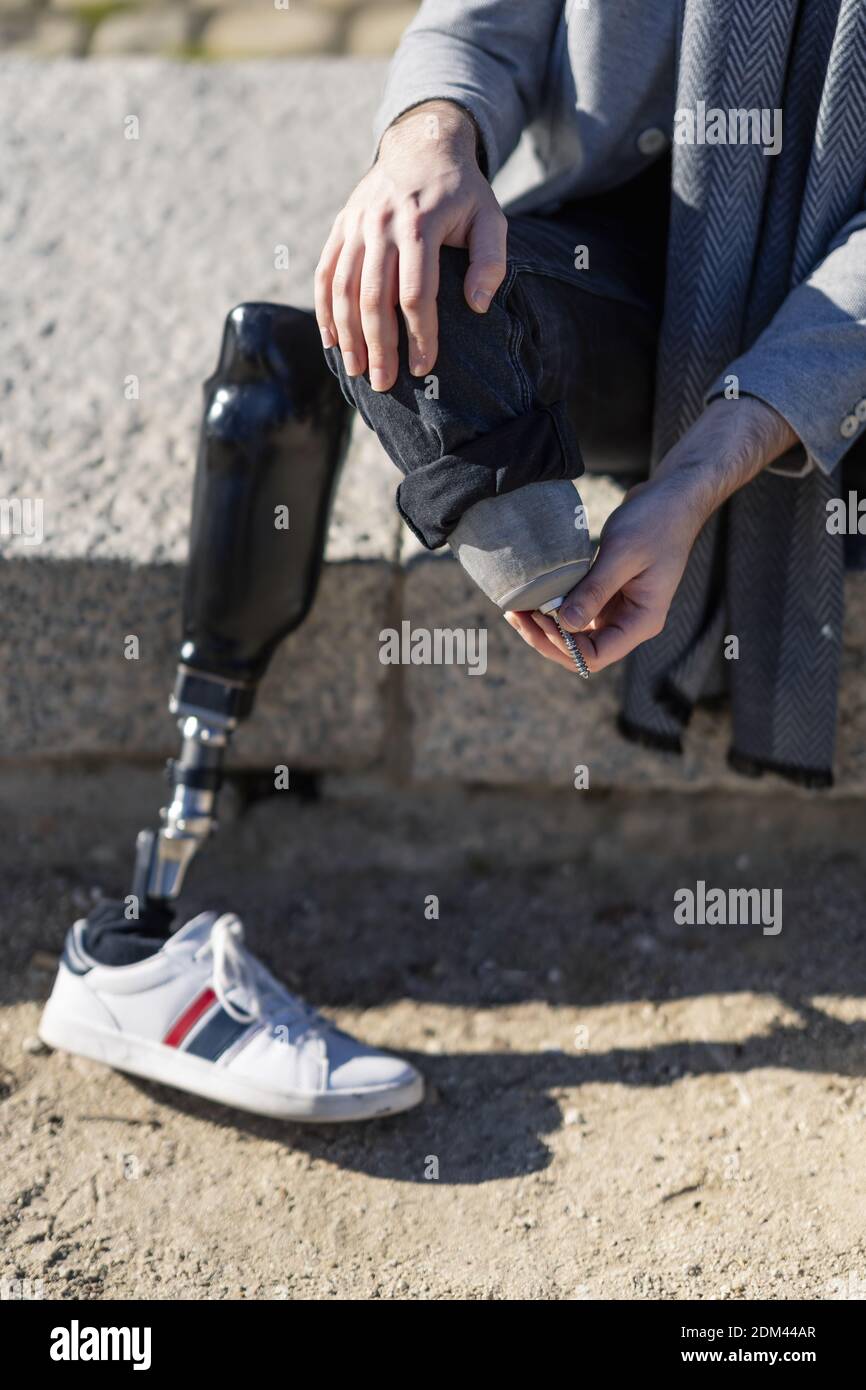 A closeup shot of a disabled young man with foot prosthesis sitting ...