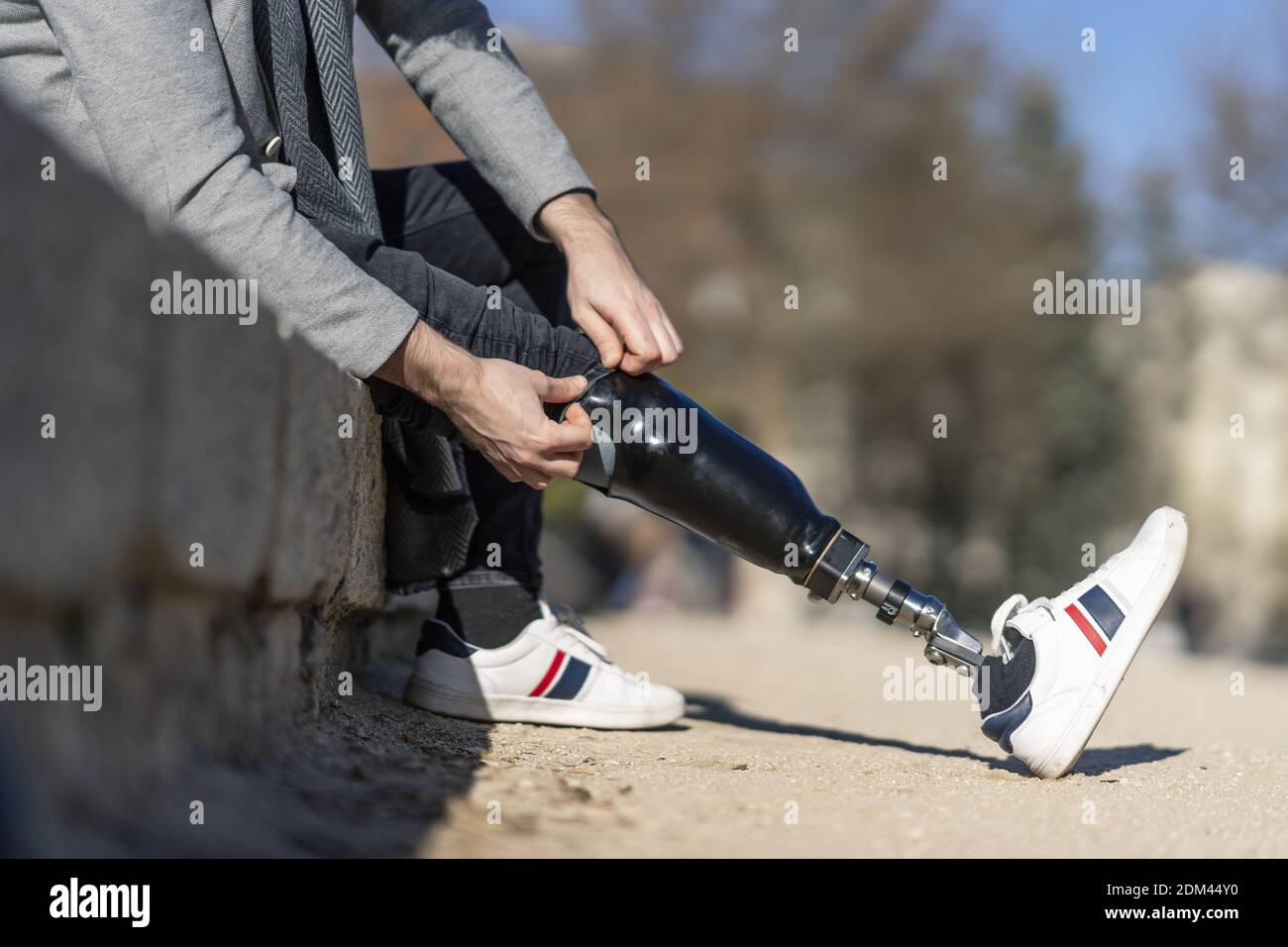A closeup shot of a disabled young man with foot prosthesis sitting ...