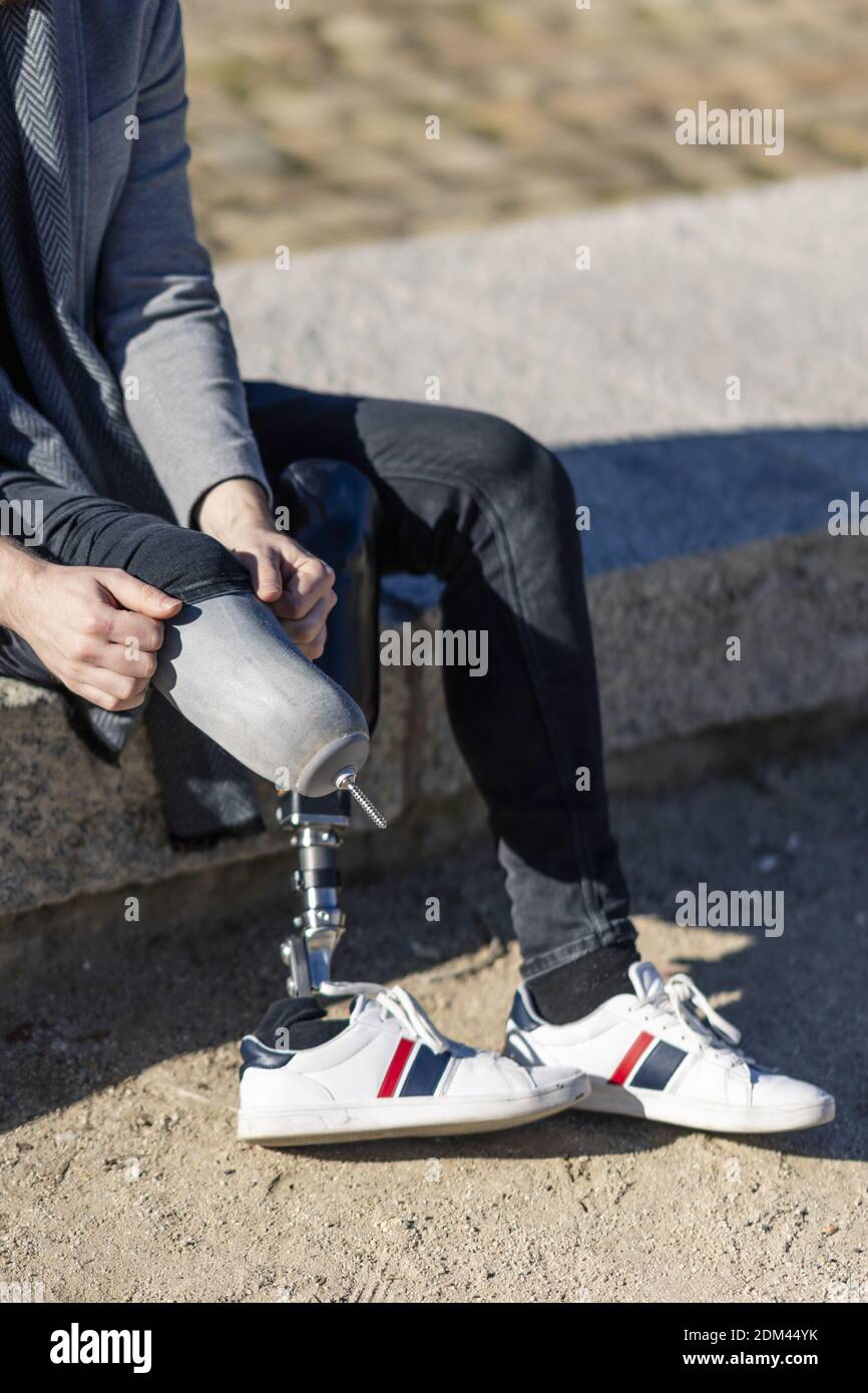 A closeup shot of a disabled young man with foot prosthesis sitting ...