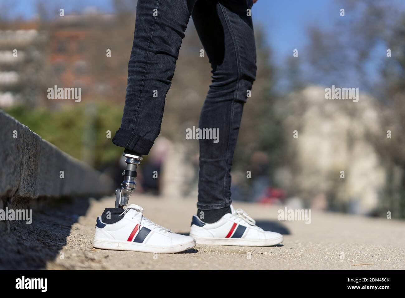 A closeup shot of a disabled young man with foot prosthesis sitting ...