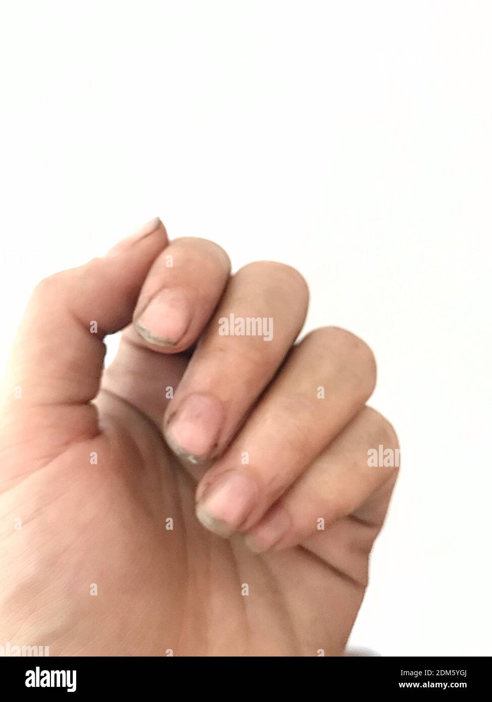 Dirty Fingernails High Resolution Stock Photography and Images - Alamy