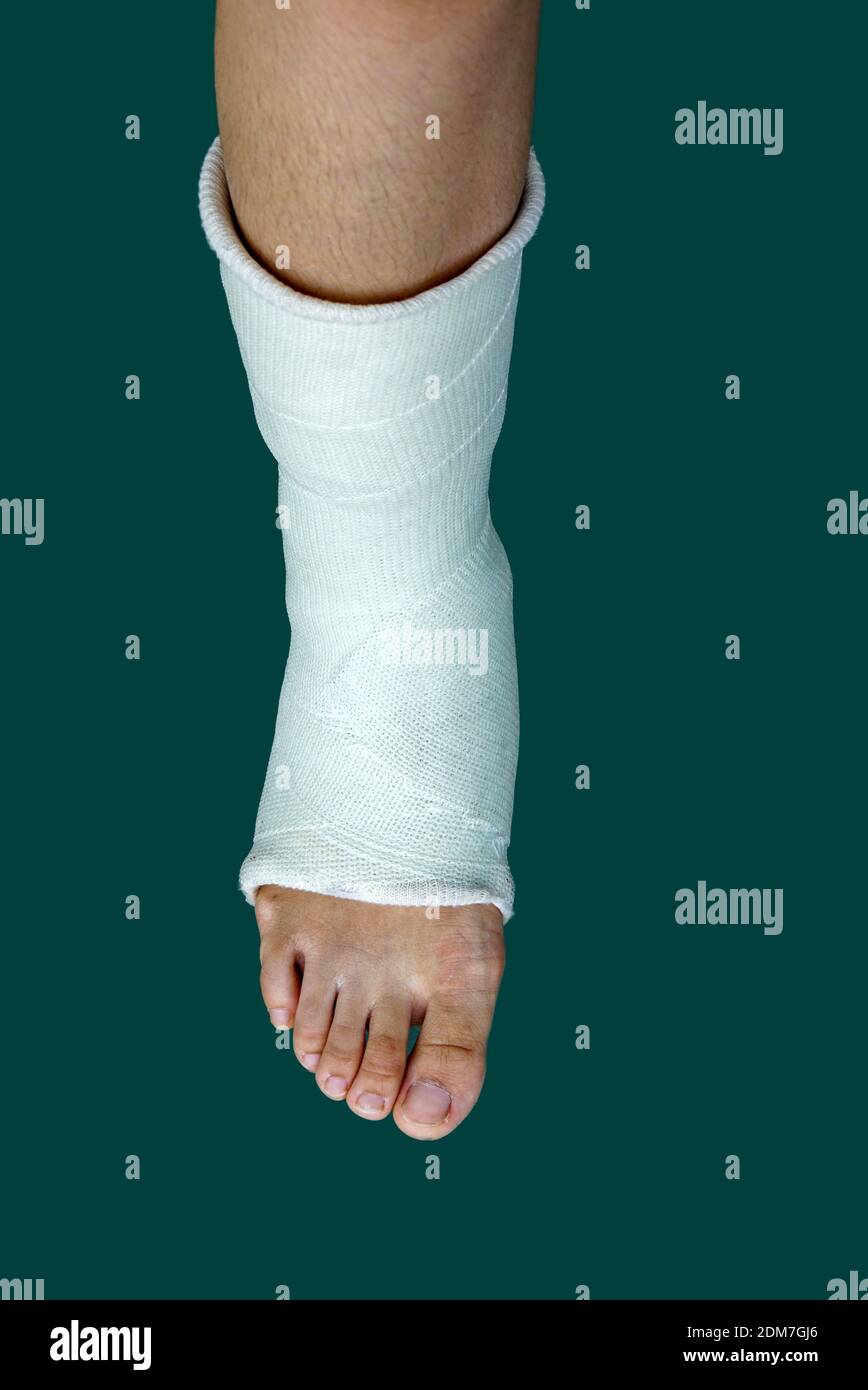 Man Fractured Leg High Resolution Stock Photography and Images - Alamy