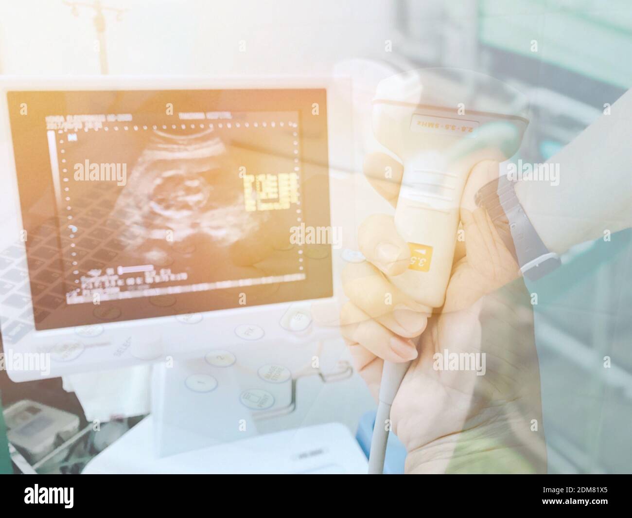 Exposure monitoring hi-res stock photography and images - Alamy