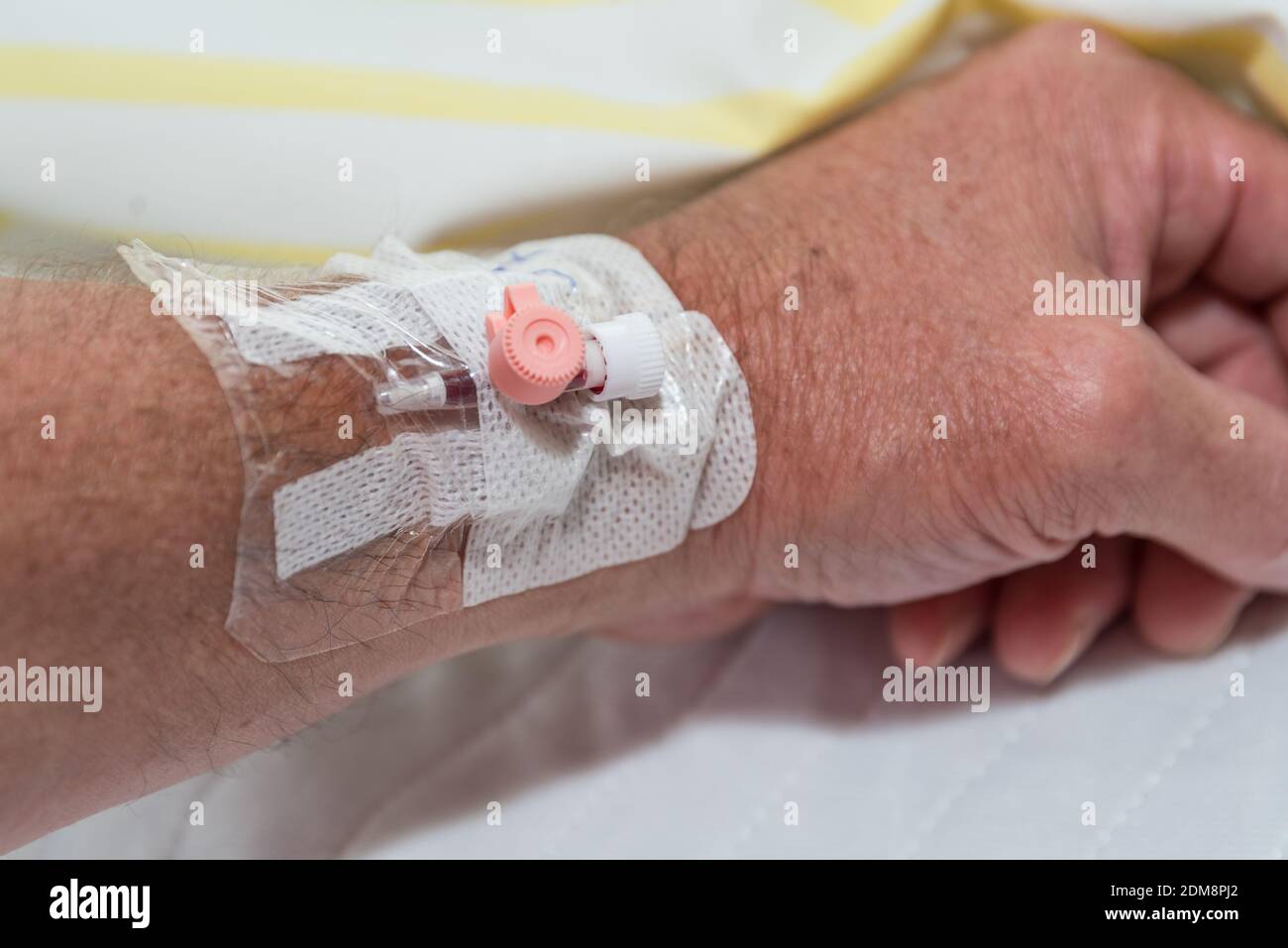 Venflon, A Laid Venous Catheter - Cannula For Infusion Stock Photo - Alamy