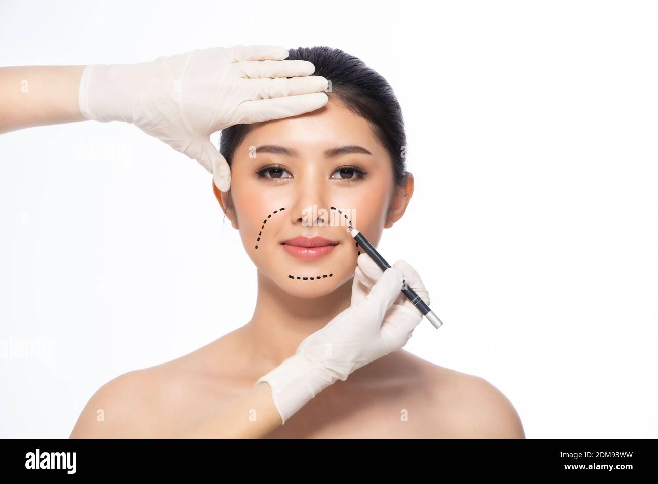 Woman plastic surgery markings on hi-res stock photography and images ...