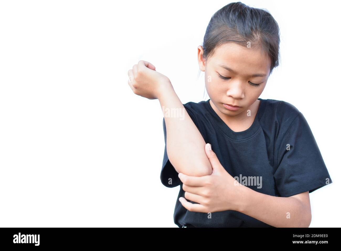 Girl scratching arm Cut Out Stock Images & Pictures - Alamy