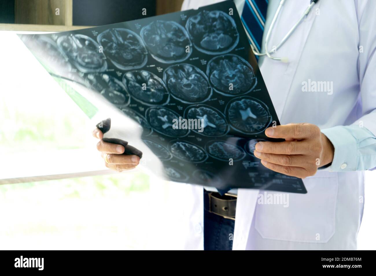 Film mri brain brain tumor hi-res stock photography and images - Alamy