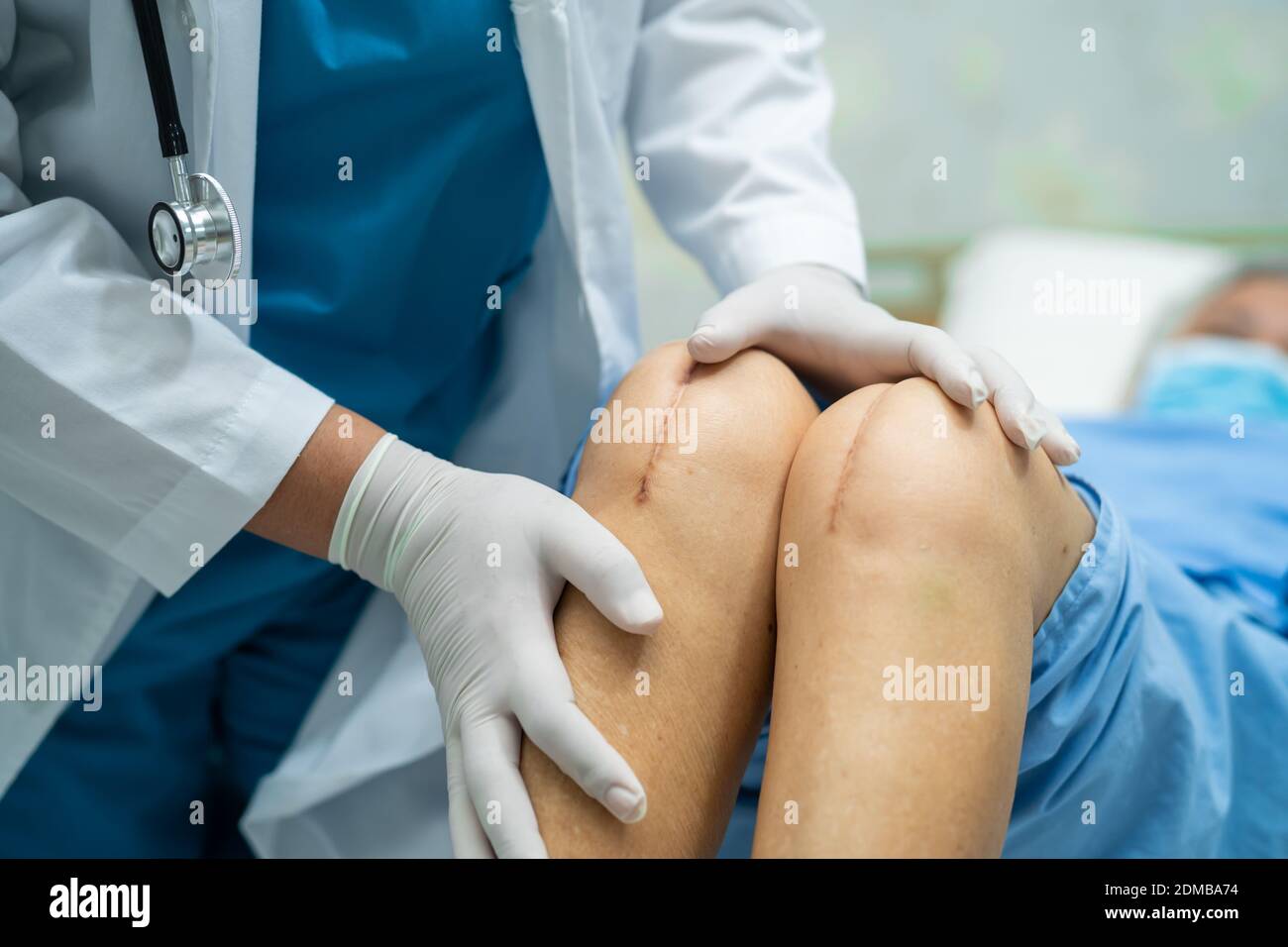 Total Knee Replacement High Resolution Stock Photography and Images - Alamy