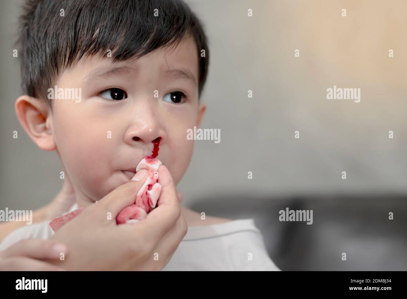 Epistaxis hi-res stock photography and images - Alamy