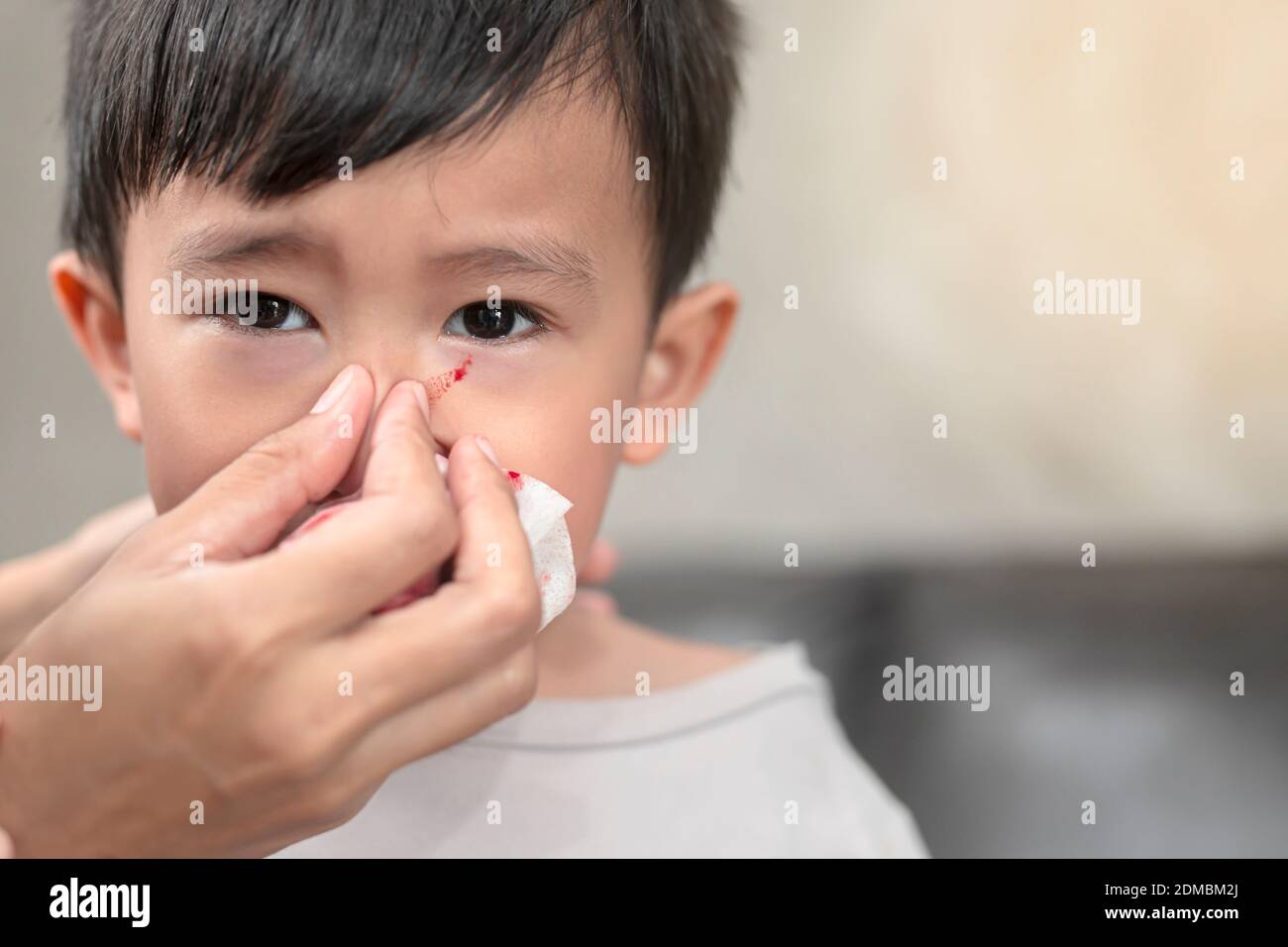Nosebleed boy hi-res stock photography and images - Alamy