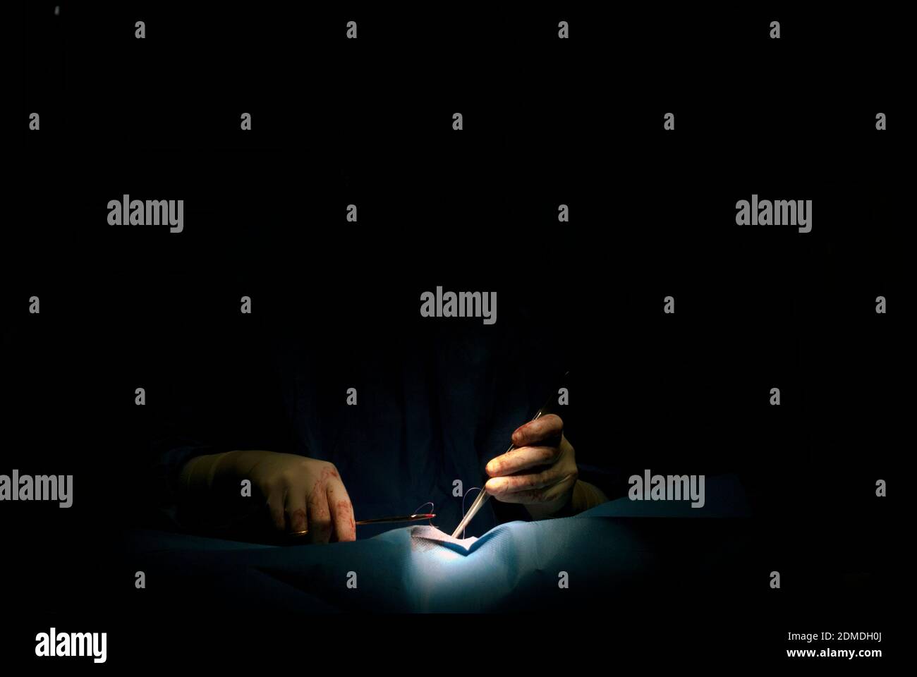Stitching the wound hi-res stock photography and images - Alamy