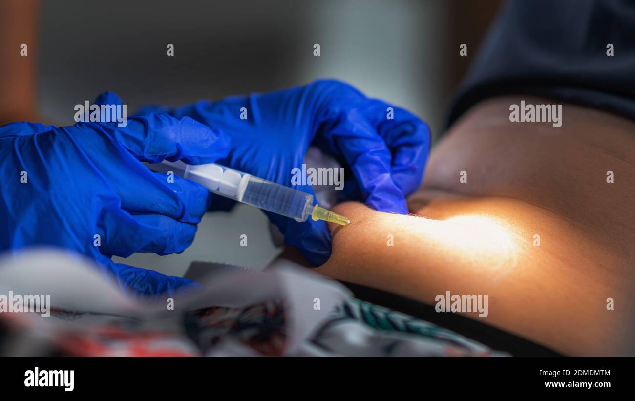 Injection lipolysis hi-res stock photography and images - Alamy