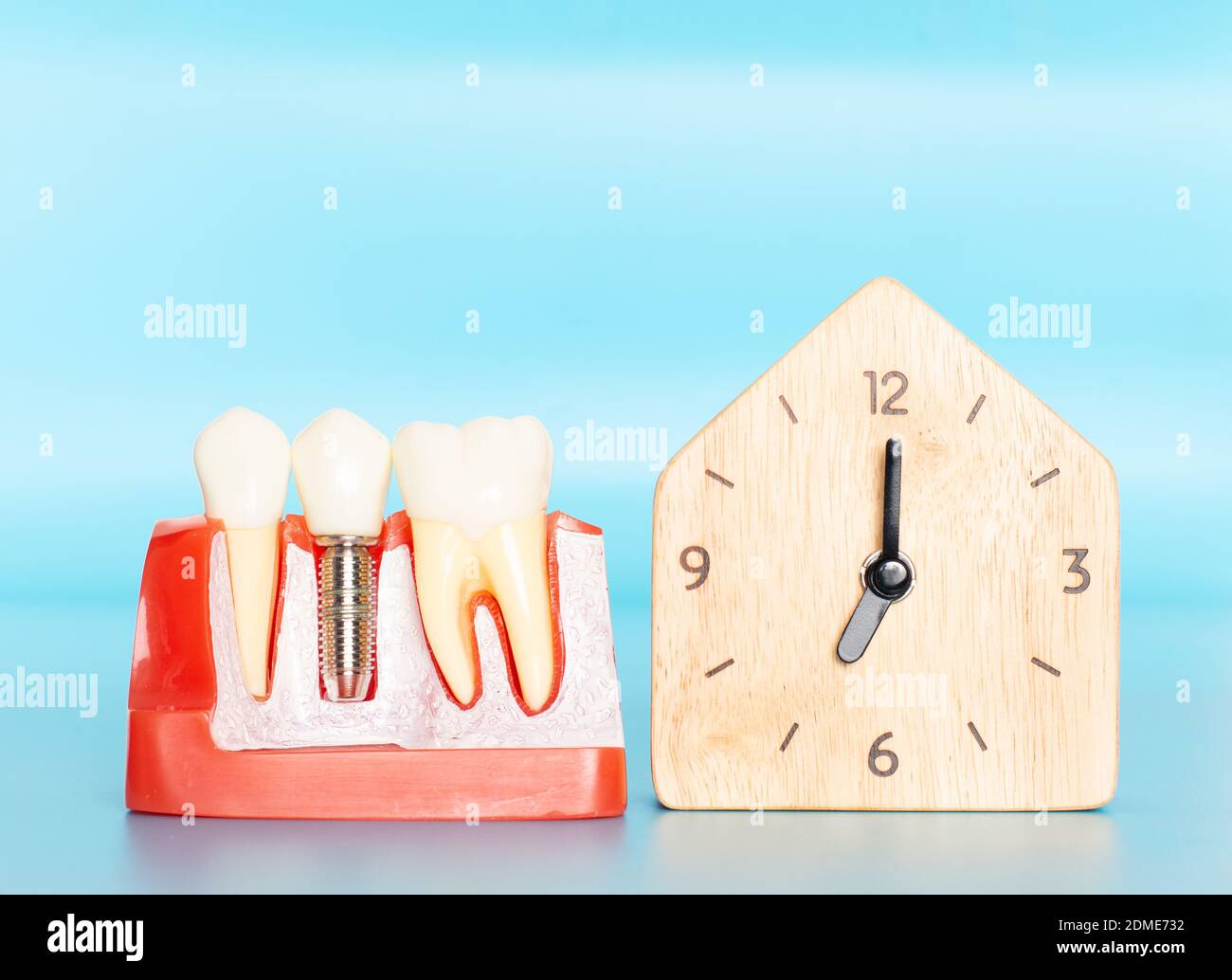 Rebuilding human jaw hi-res stock photography and images - Alamy