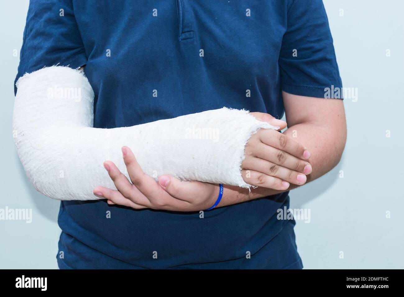 Fiberglass Cast High Resolution Stock Photography and Images - Alamy