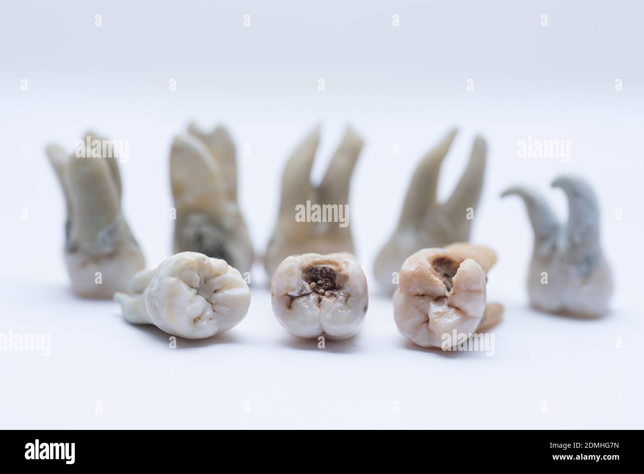 Human teeth row hi-res stock photography and images - Alamy