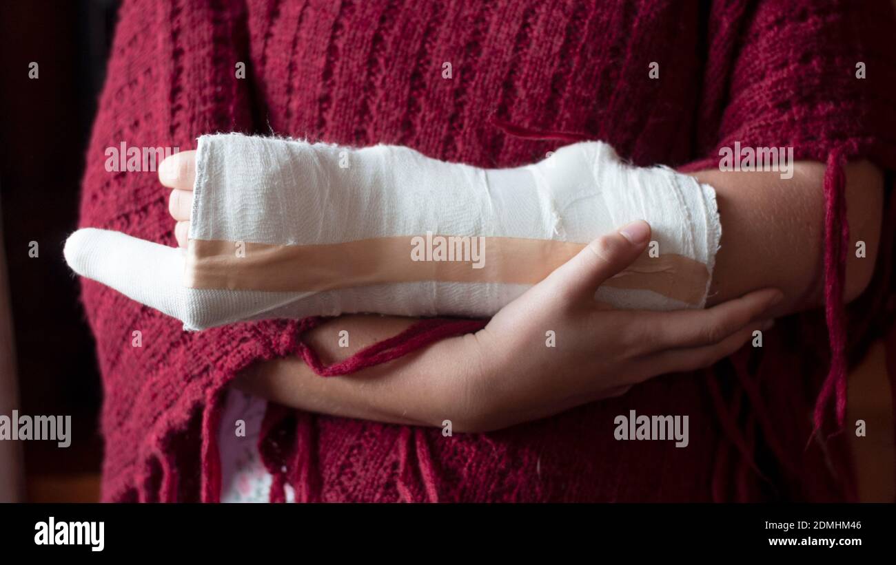 Fractured finger hi-res stock photography and images - Alamy