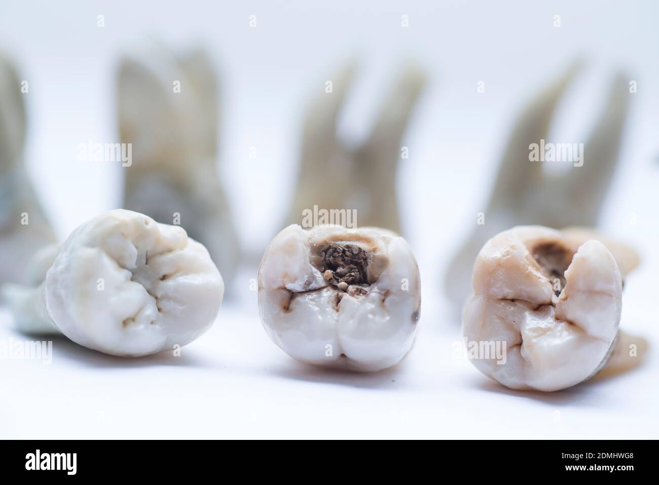 Human teeth row hi-res stock photography and images - Alamy
