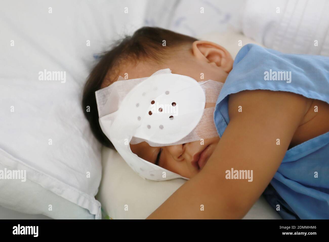 Boy with bandage on eye hi-res stock photography and images - Alamy