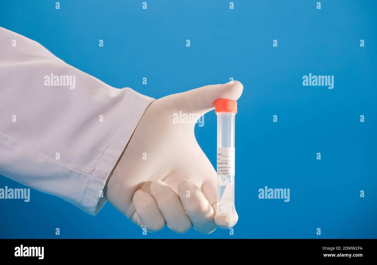 Serological test vial for laboratory in the hands of a doctor with ...