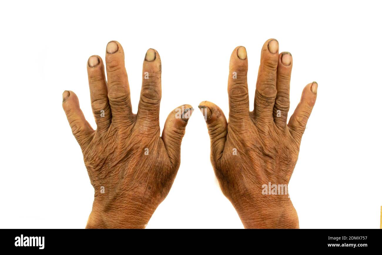 Close-up Of Wrinkled Human Hands Against White Background Stock Photo ...