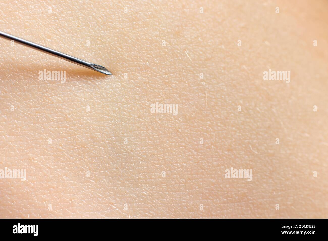 Macro photo of a medical needle with a syringe on a person's body on ...